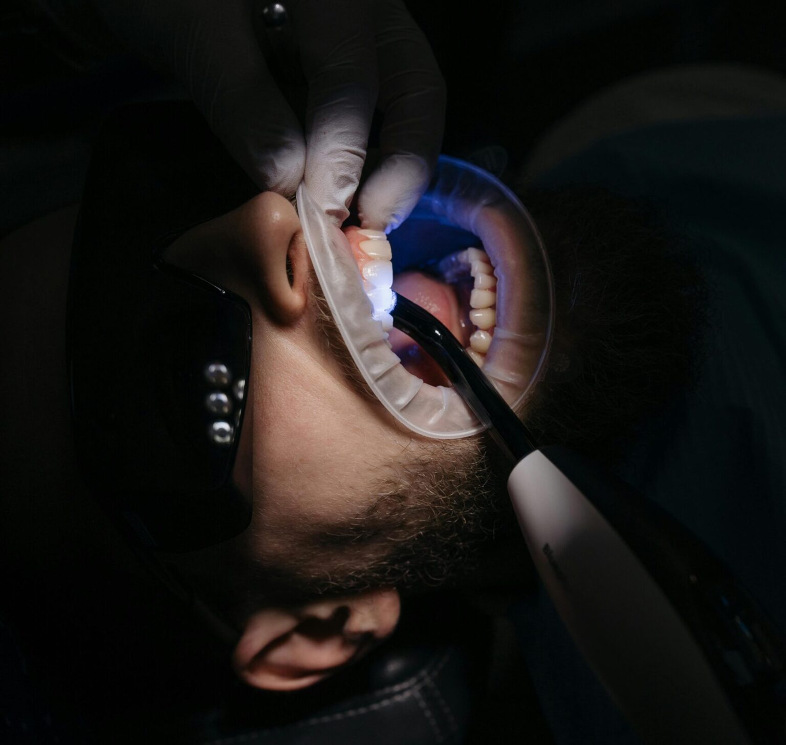 10 Shocking Habits That Are Destroying Your Teeth Right Now! - Health ...